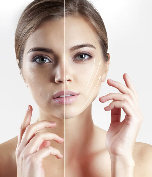 5 Healthy Ways To Lift The Sagging Skin On Face | ShineSheets - Elevate ...
